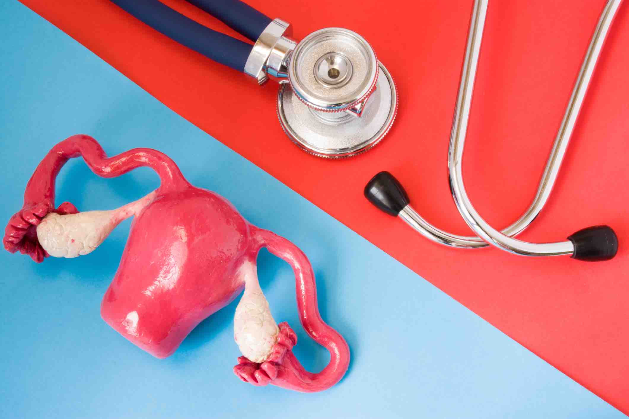 Ovaires artificiels & problème ovarien – Solution à l’infertilité